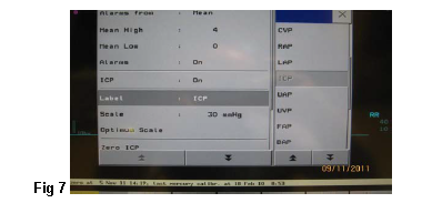 ICP monitoring SOP | NHSGGC